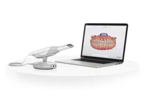 iTero Intraoral Scanner for Dental Treatments at Mahimaa Dental Care